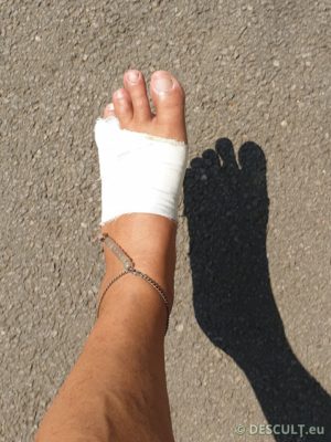 Mi-am rupt piciorul… oarecum – Andrei DESCULŢ